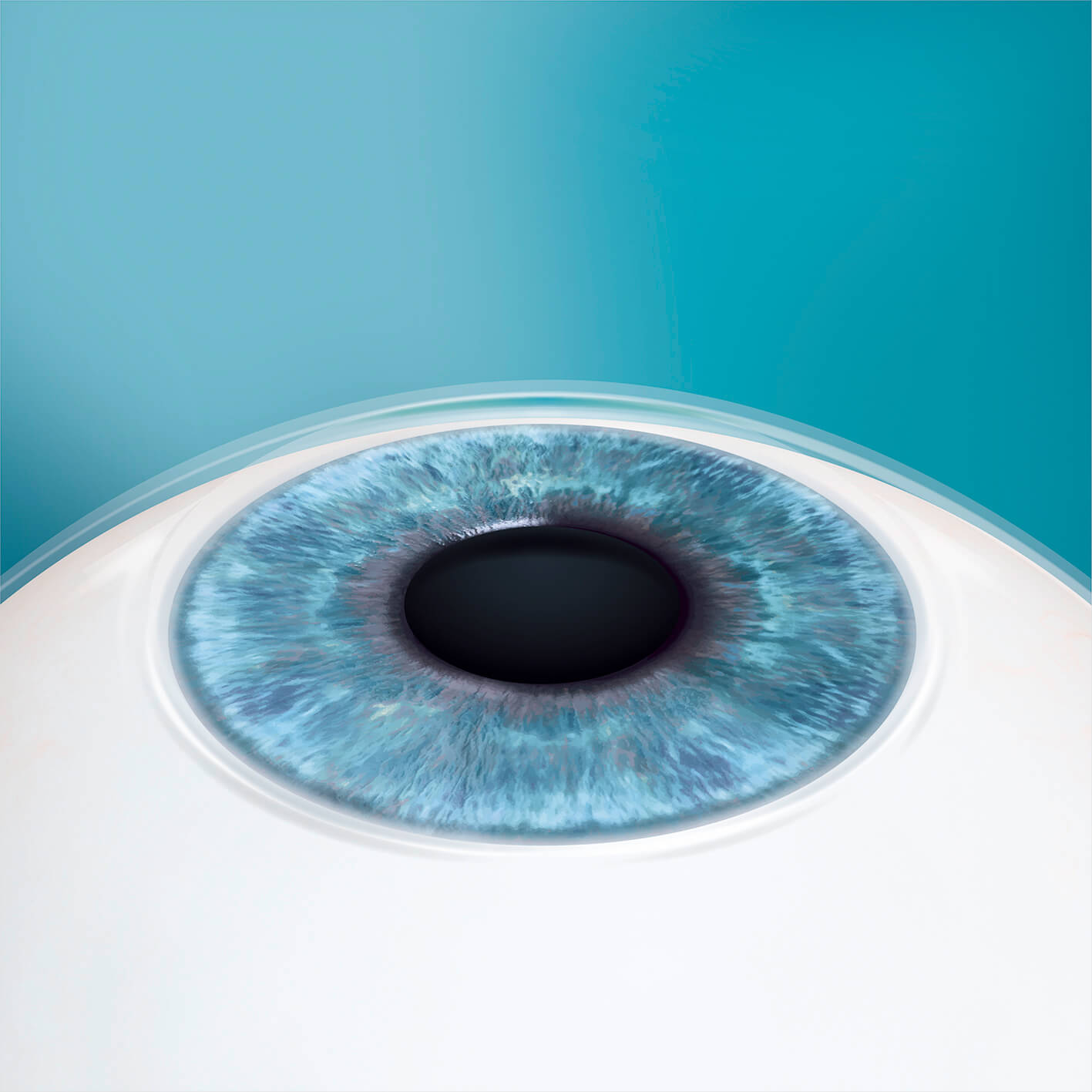 EVO ICL Charlotte | Vision Correction Rock Hill, NC | Metrolina Eye
